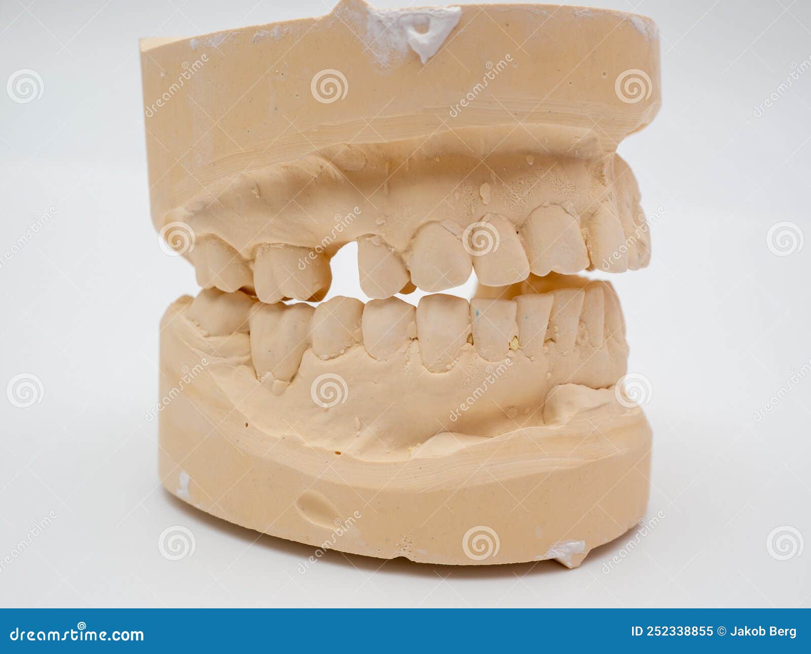 Plaster Model or Cast of Human Teeth. Stock Image - Image of medicine ...