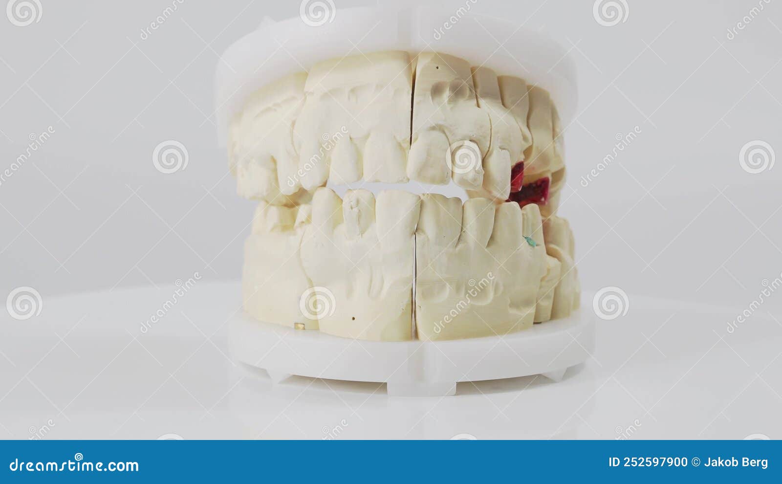 Plaster Model or Cast of Human Teeth. Teeth Model on a White Background ...