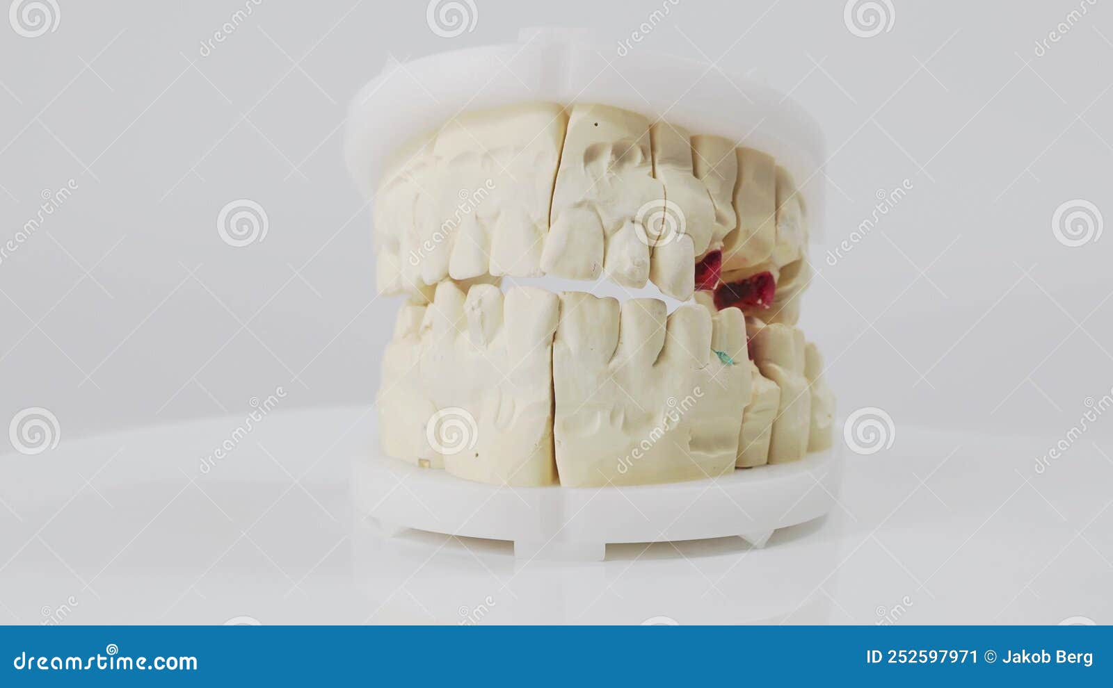 Plaster Model or Cast of Human Teeth. Teeth Model on a White Background ...