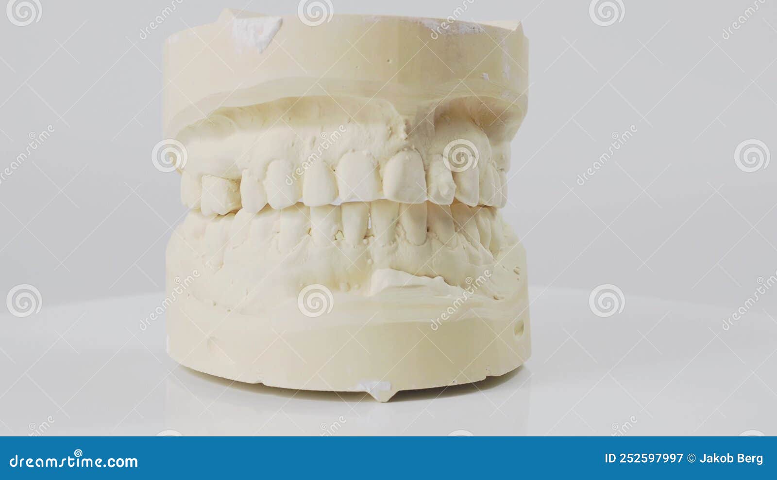 Plaster Model or Cast of Human Teeth. Teeth Model on a White Background ...