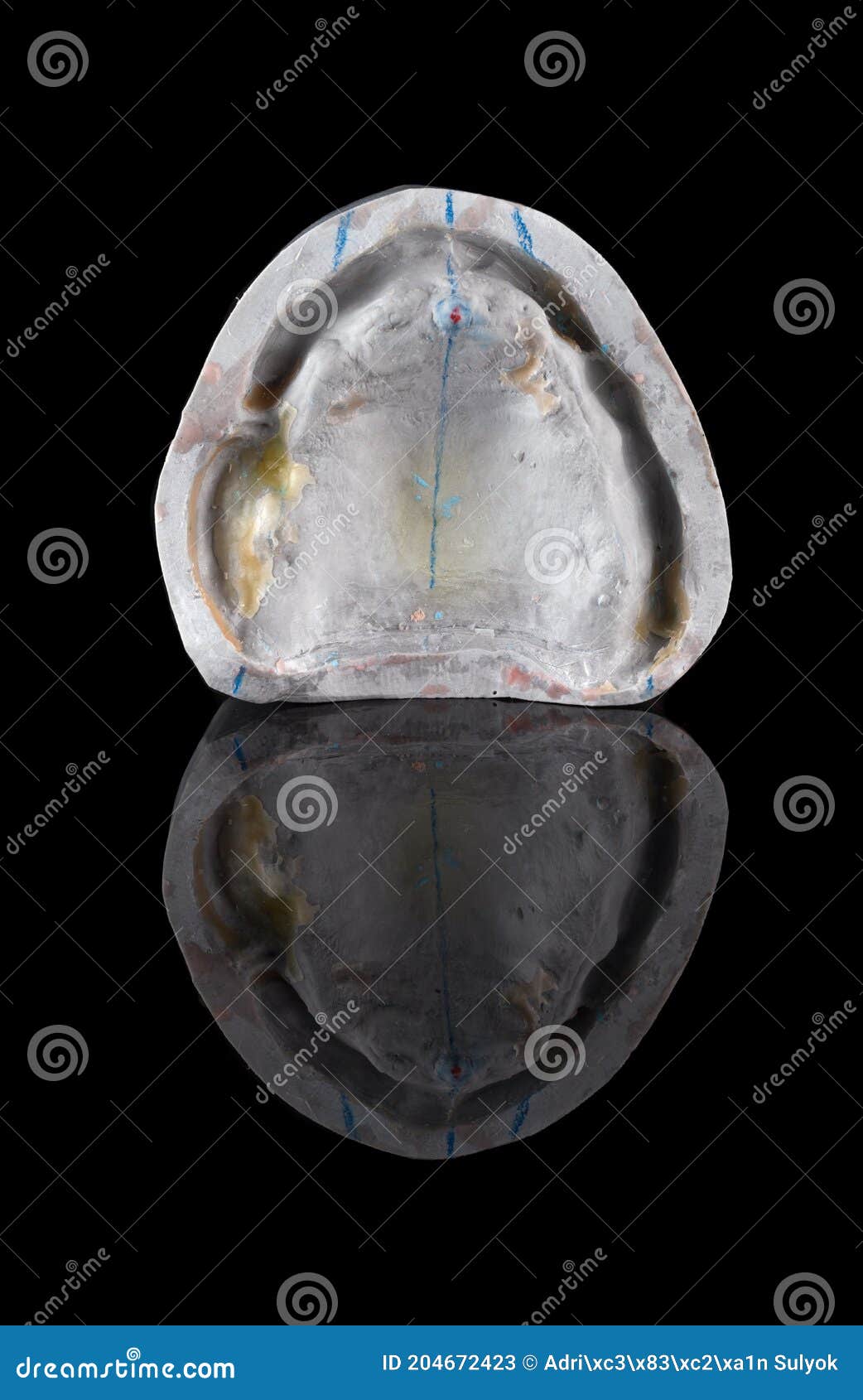 The Plaster Model of Complete Maxillary Denture Stock Image - Image of ...