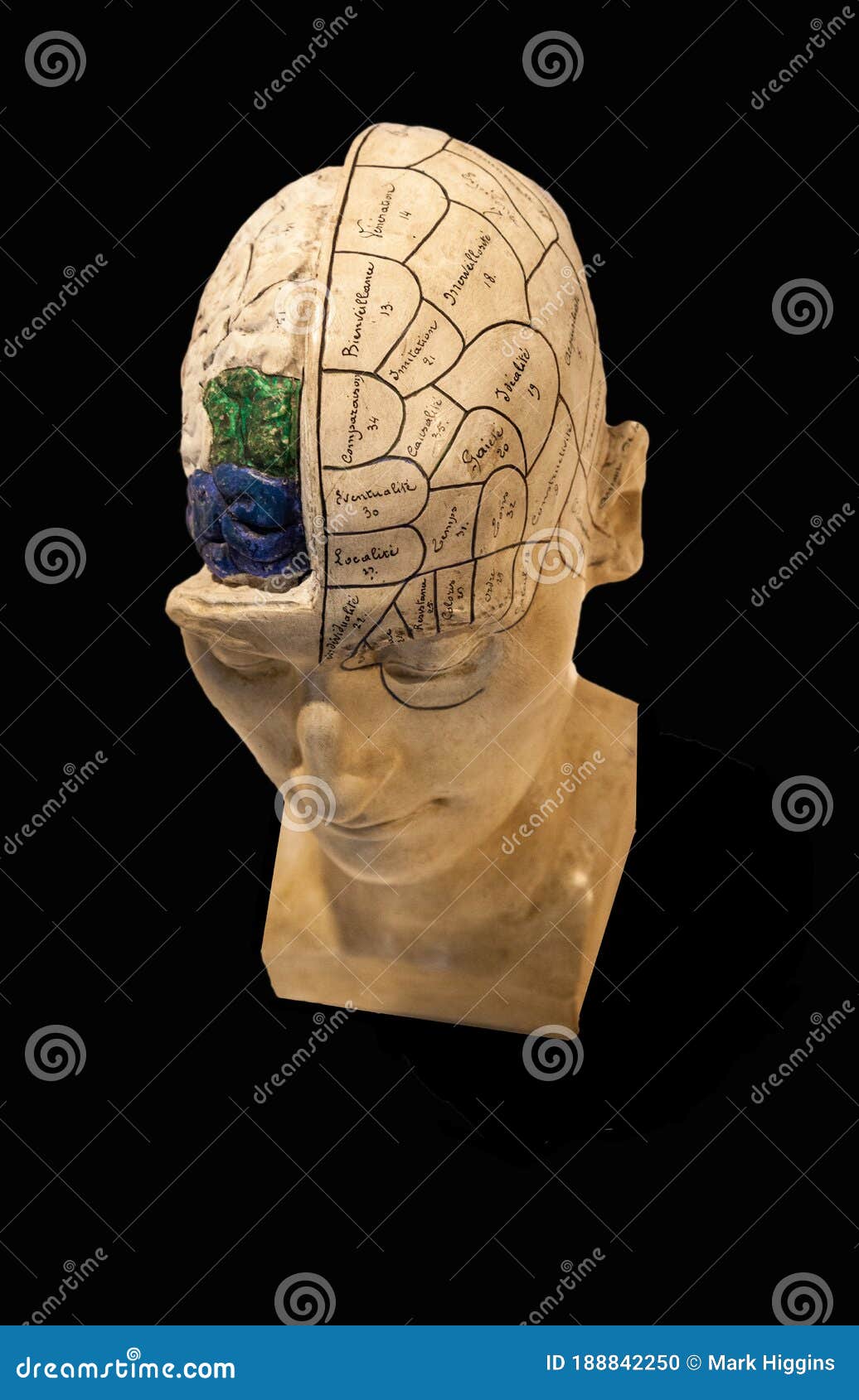 Exposed brain stock photo. Image of british, health - 188842250