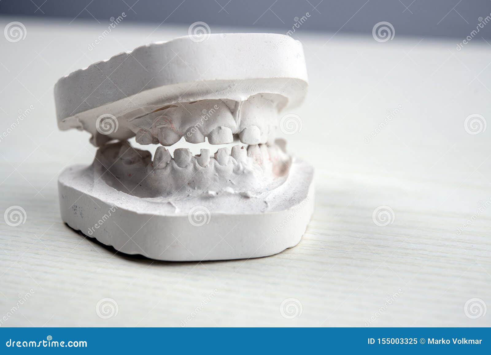 Plaster model of teeth stock image. Image of orthodontics - 155003325