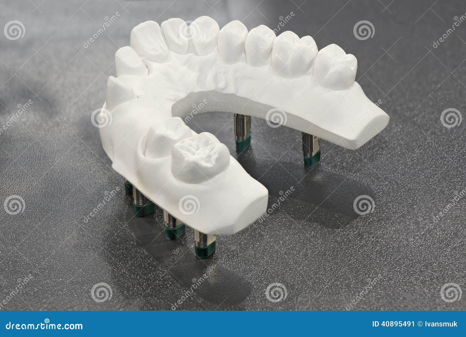 The Plaster Model Of Complete Maxillary Denture Royalty-Free Stock ...