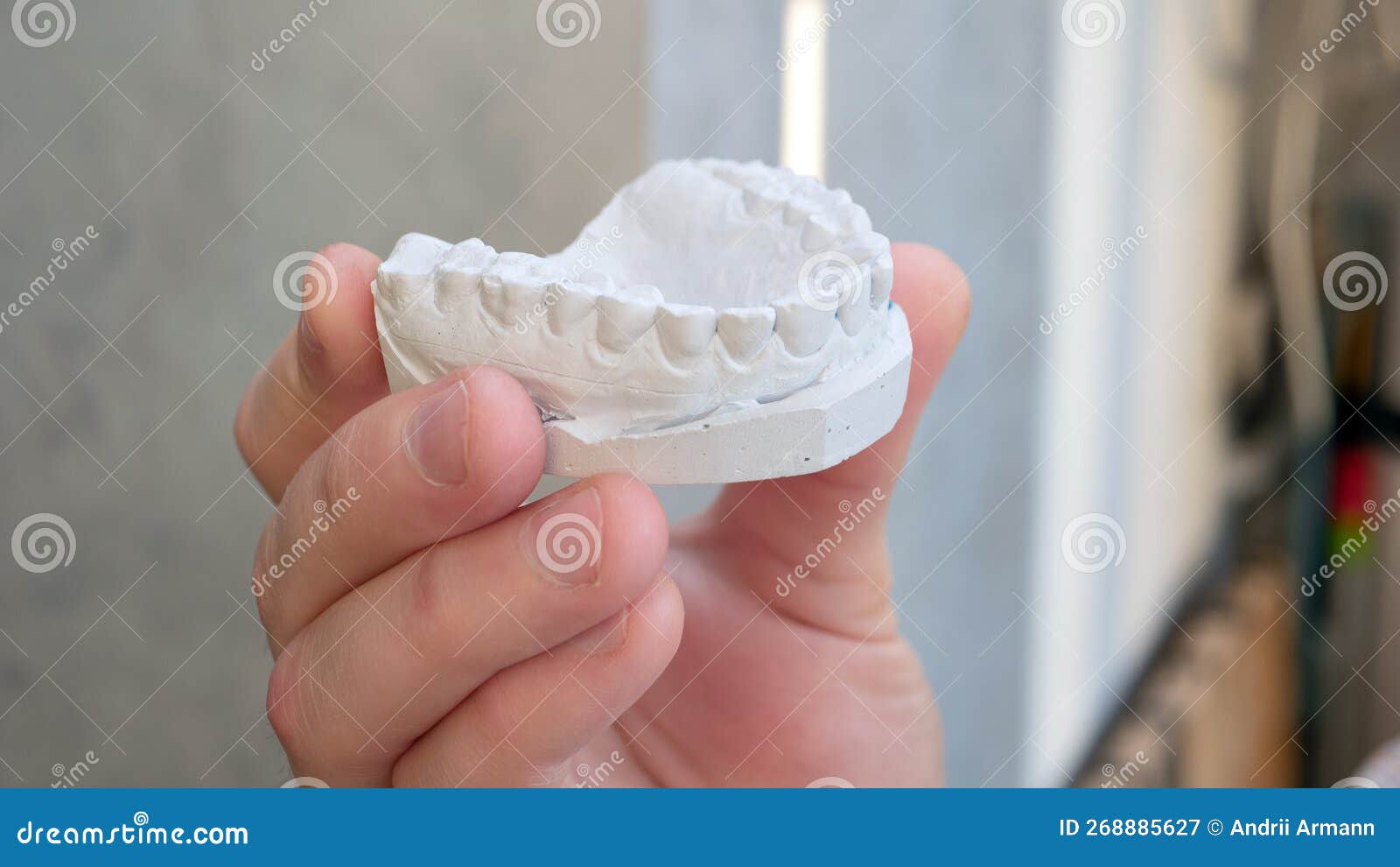 Plaster Teeth of a Man in the Hands of a Man, Teeth Mock-up for a Cap ...