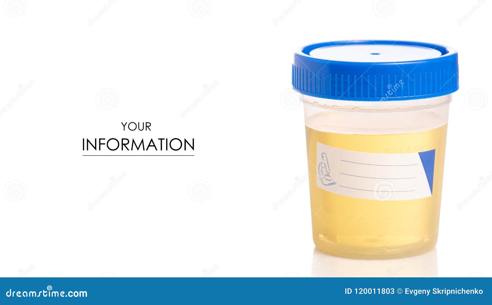 Urine Analysis On Blurred Background. Royalty-Free Stock Image ...