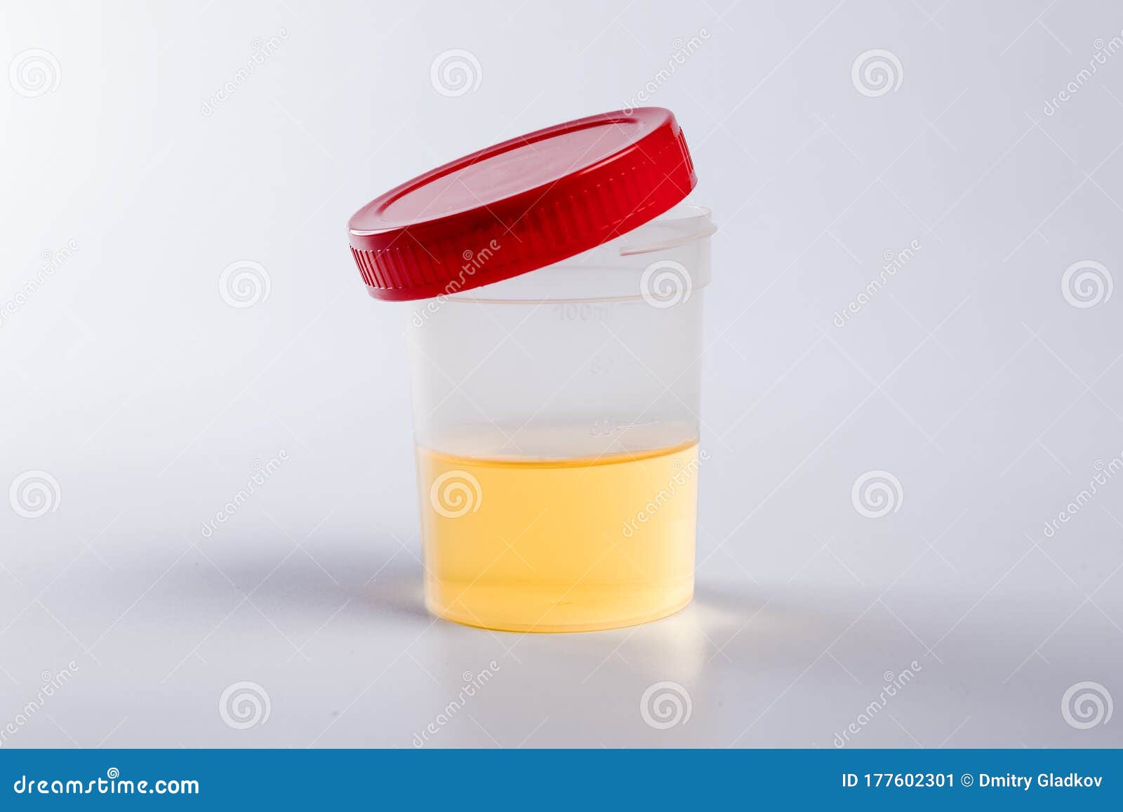 Plastic Container with Urine Analysis on a White Background Stock Image ...
