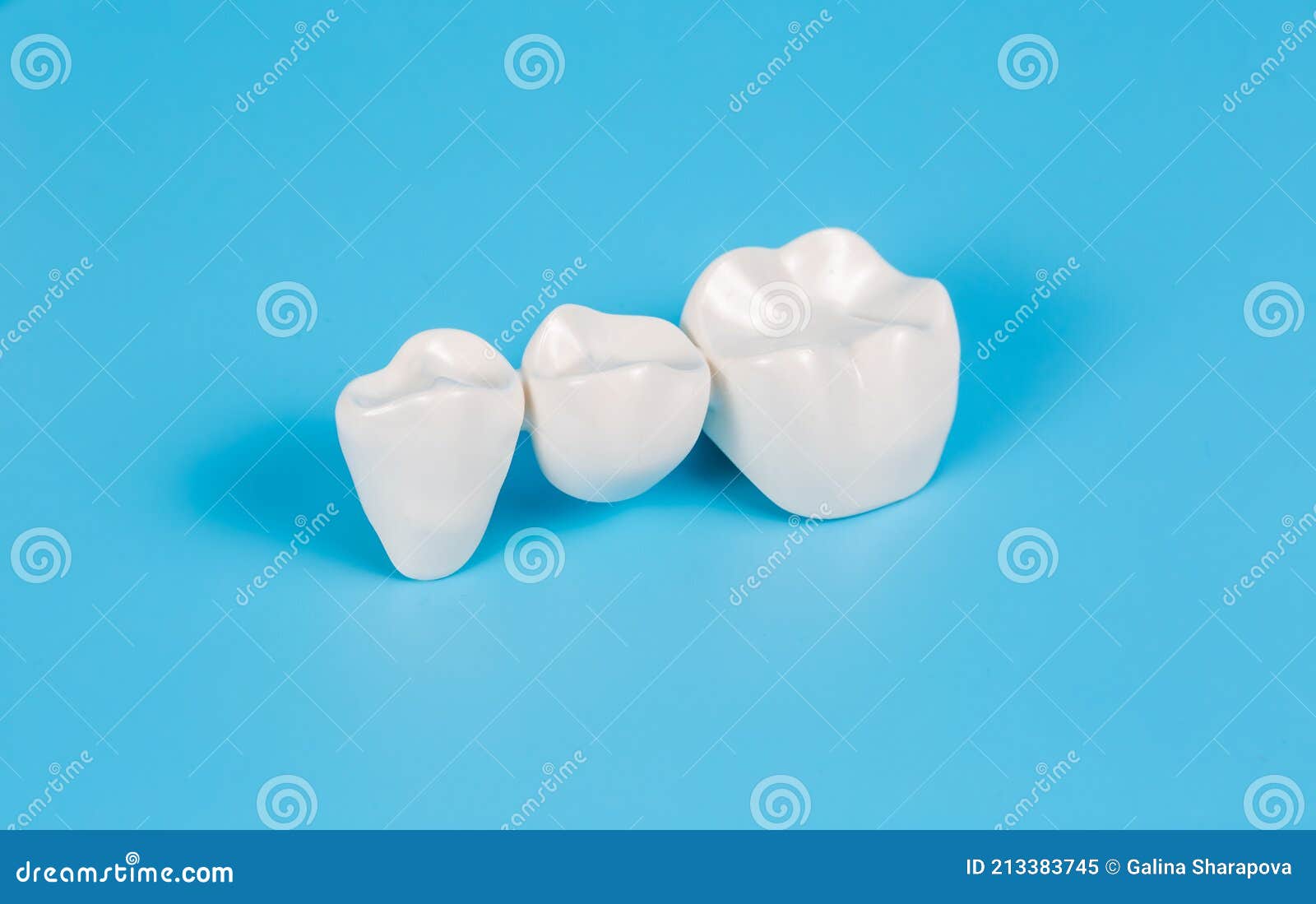 Plastic Dental Crowns, Imitation of a Dental Prosthesis of a Dental ...