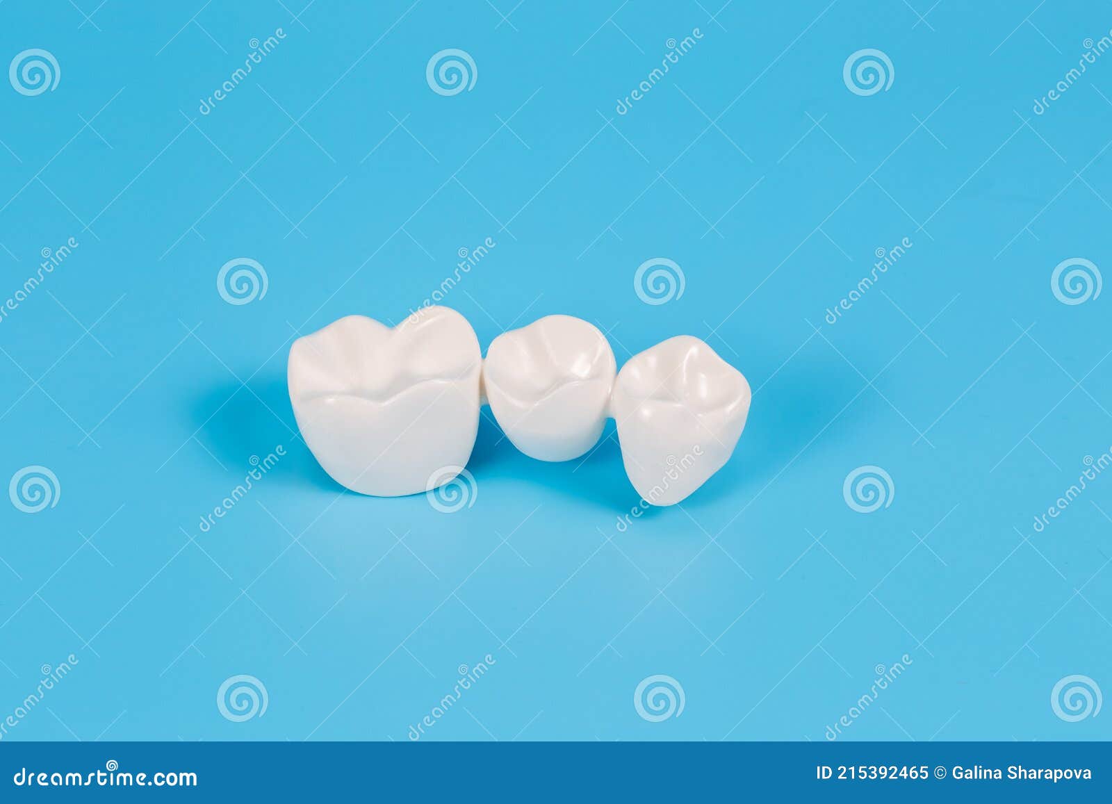 Plastic Dental Crowns, Imitation of a Dental Prosthesis of a Dental ...
