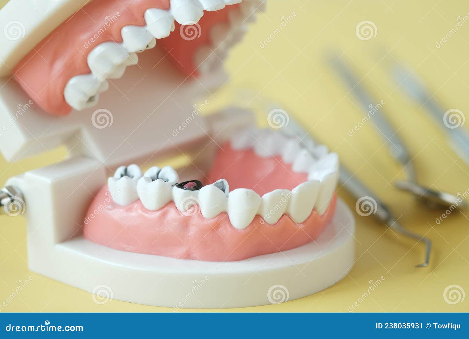 Plastic Dental Teeth Model on White Background Stock Image - Image of ...