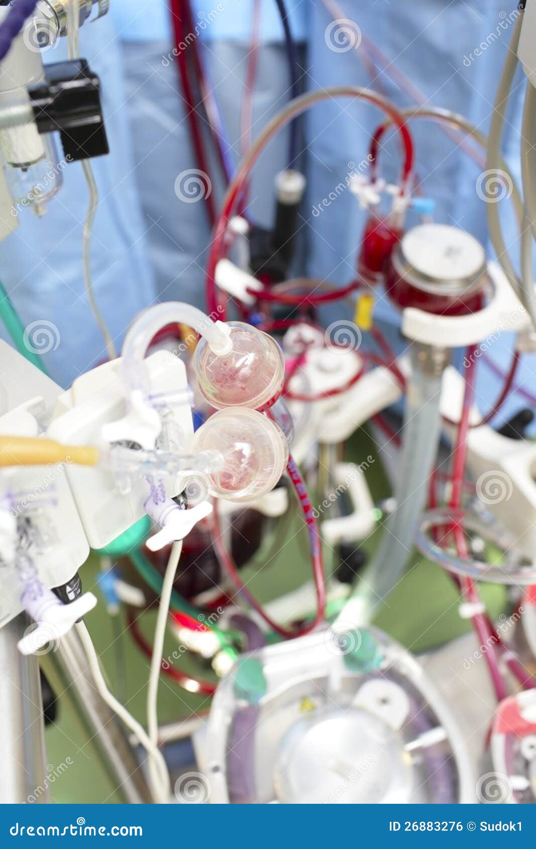 Cardiopulmonary Bypass Machine During Heart Surgery Royalty-Free Stock ...