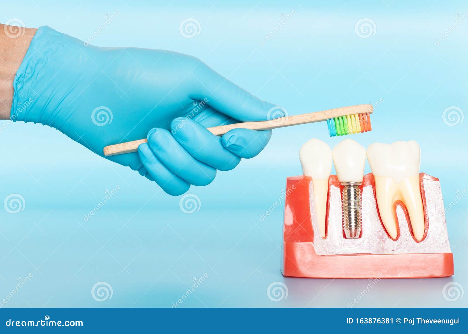 Plastic Samples of Dental Implants Compare with Natural Teeth Stock ...