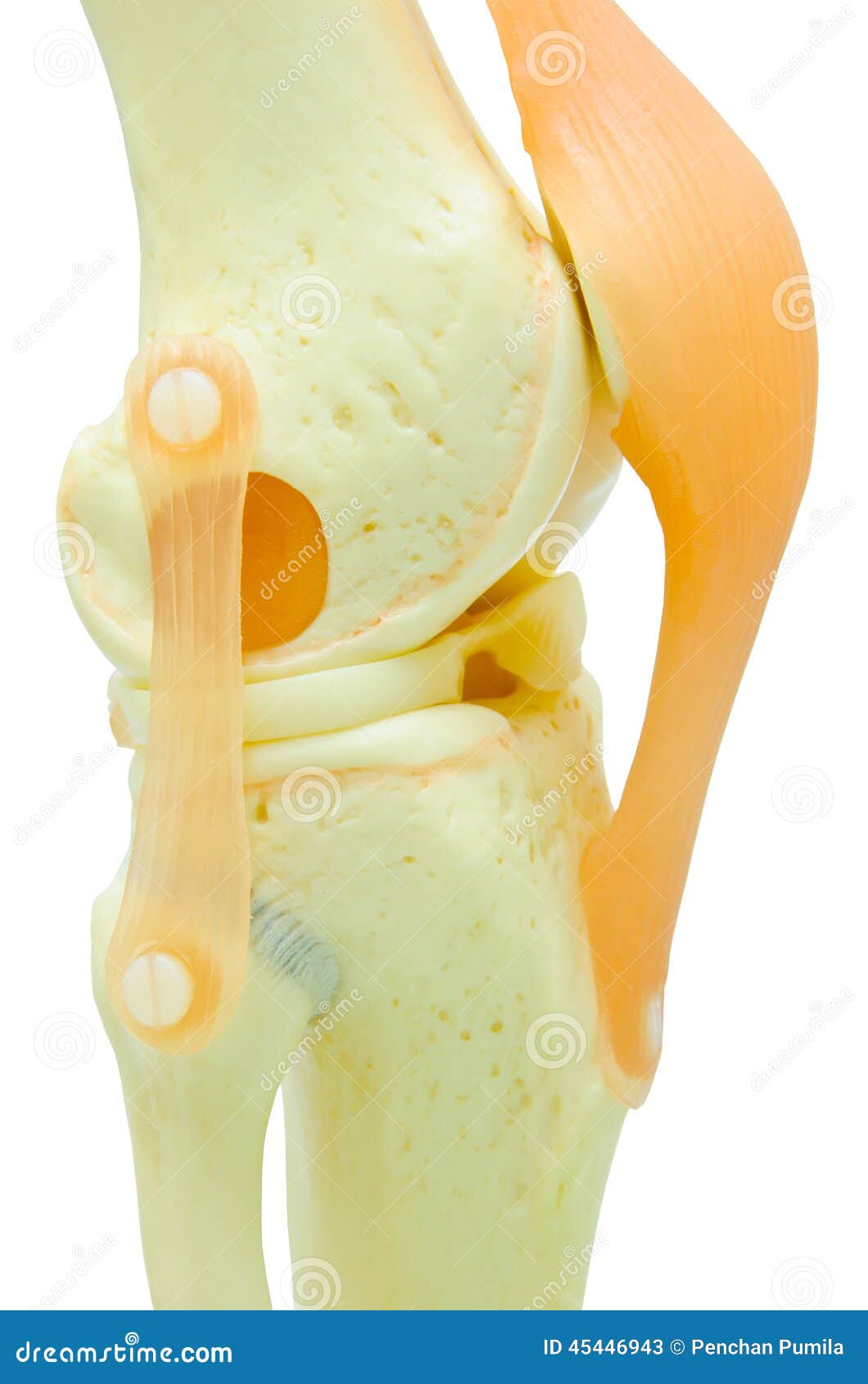 Knee Replacement Model Stock Photos - Free & Royalty-Free Stock Photos ...