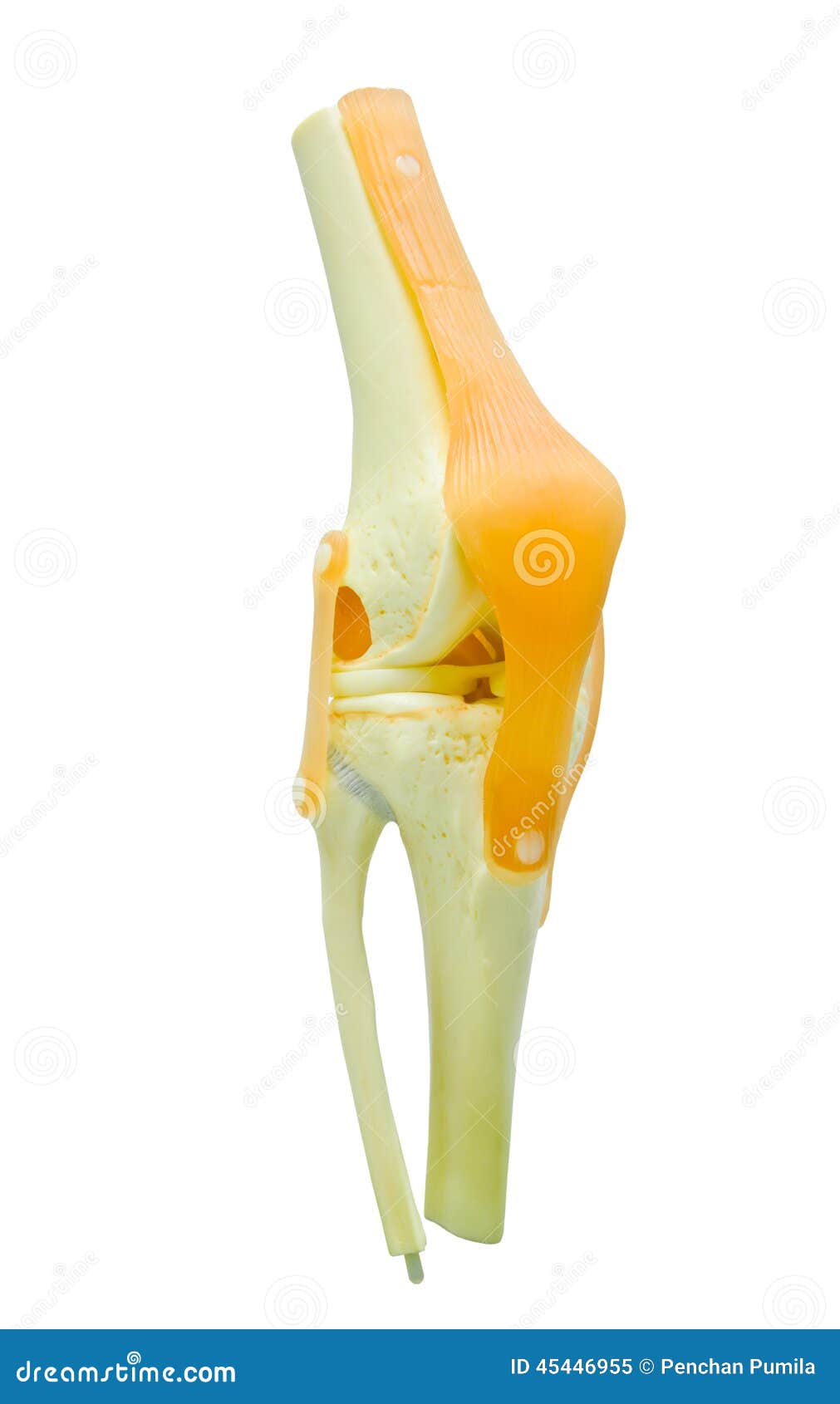Plastic Study Model of a Knee Replacement. Stock Image - Image of ...