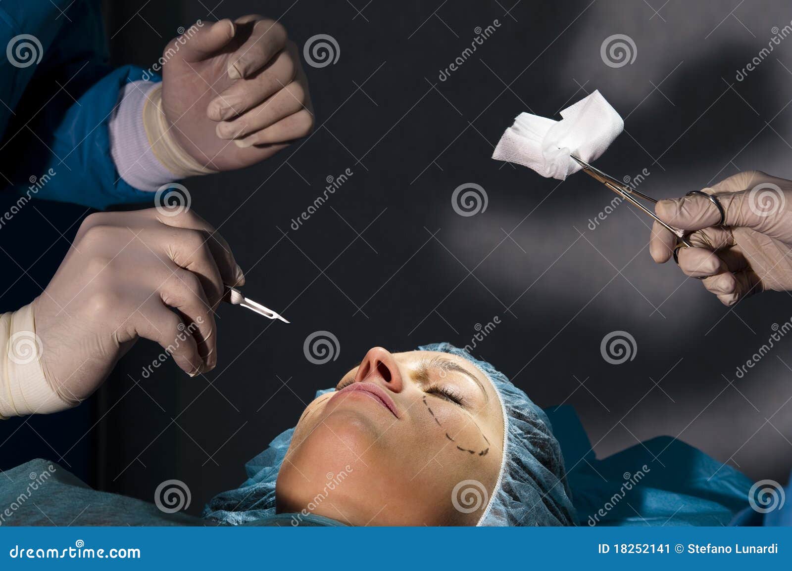 Plastic Surgery stock image. Image of process, healthcare - 18252141