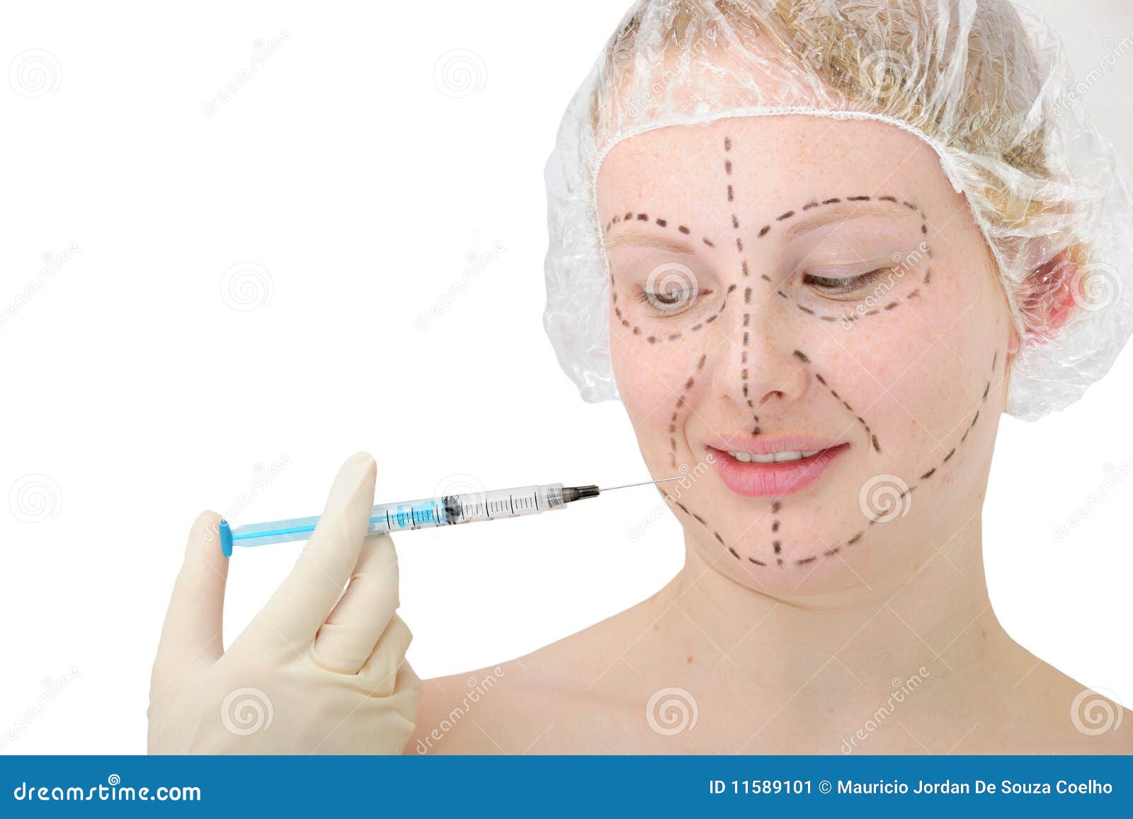 Plastic Surgery, Botox Injection Stock Image - Image of correcting ...