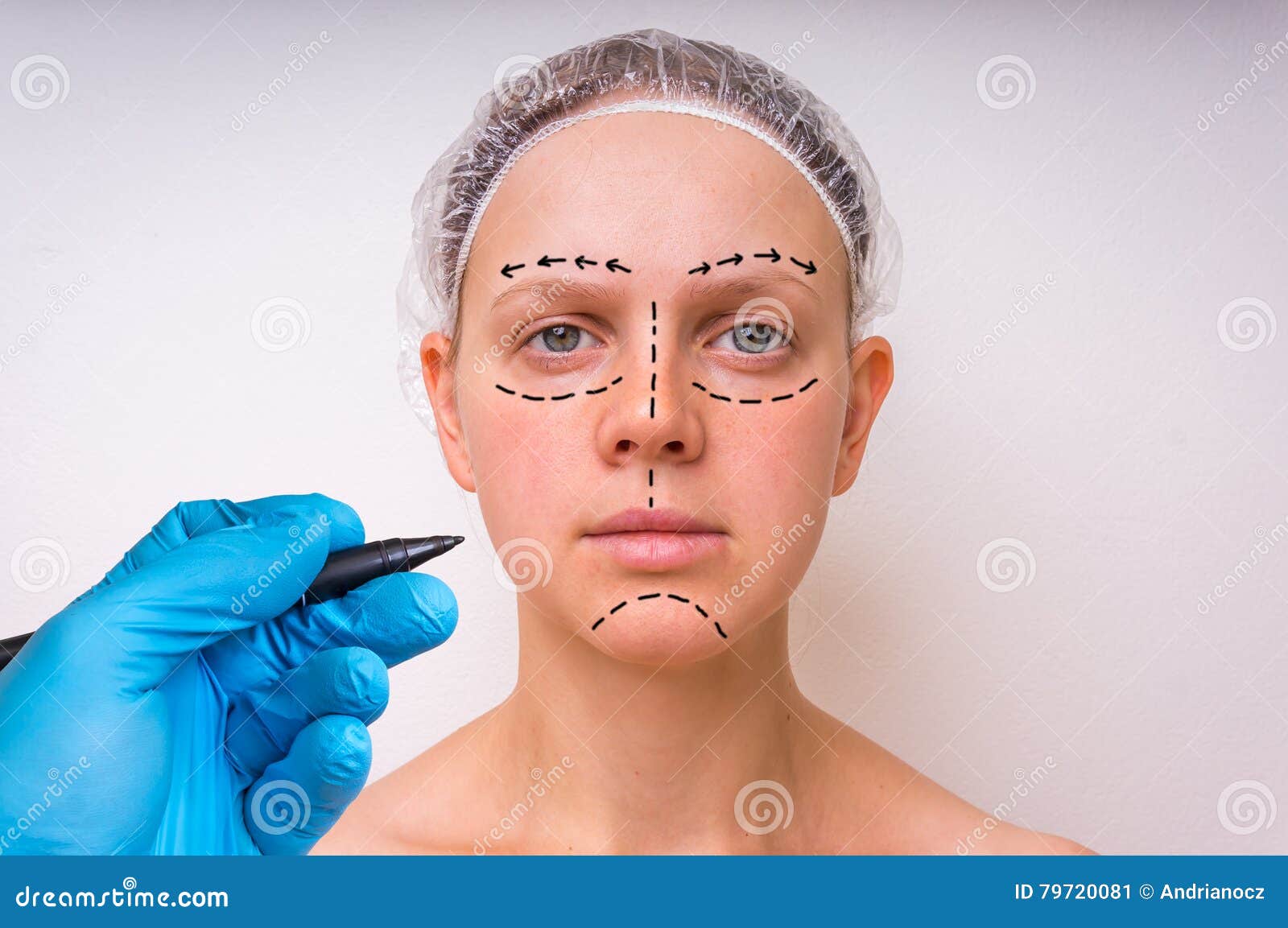 Plastic Surgery Doctor Draw Lines With Marker On Patient Face Stock ... Plastic Surgery Doctor Draw Lines With Marker On Patient Face Stock ...