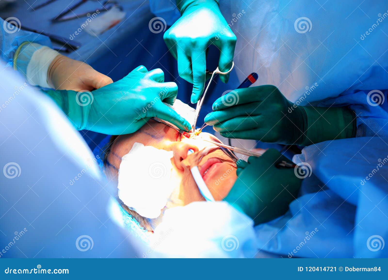 Plastic Surgery in Operating Room Stock Image - Image of room, organ ...