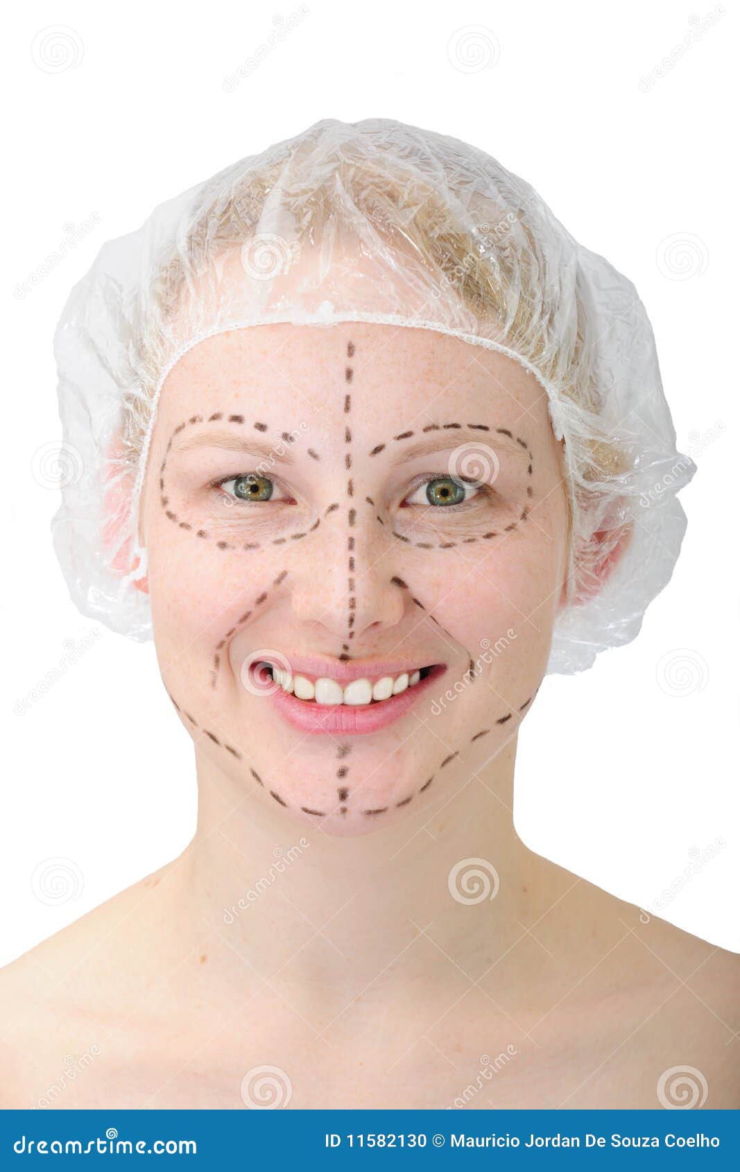 Plastic surgery/ face lift stock photo. Image of lady - 11582130