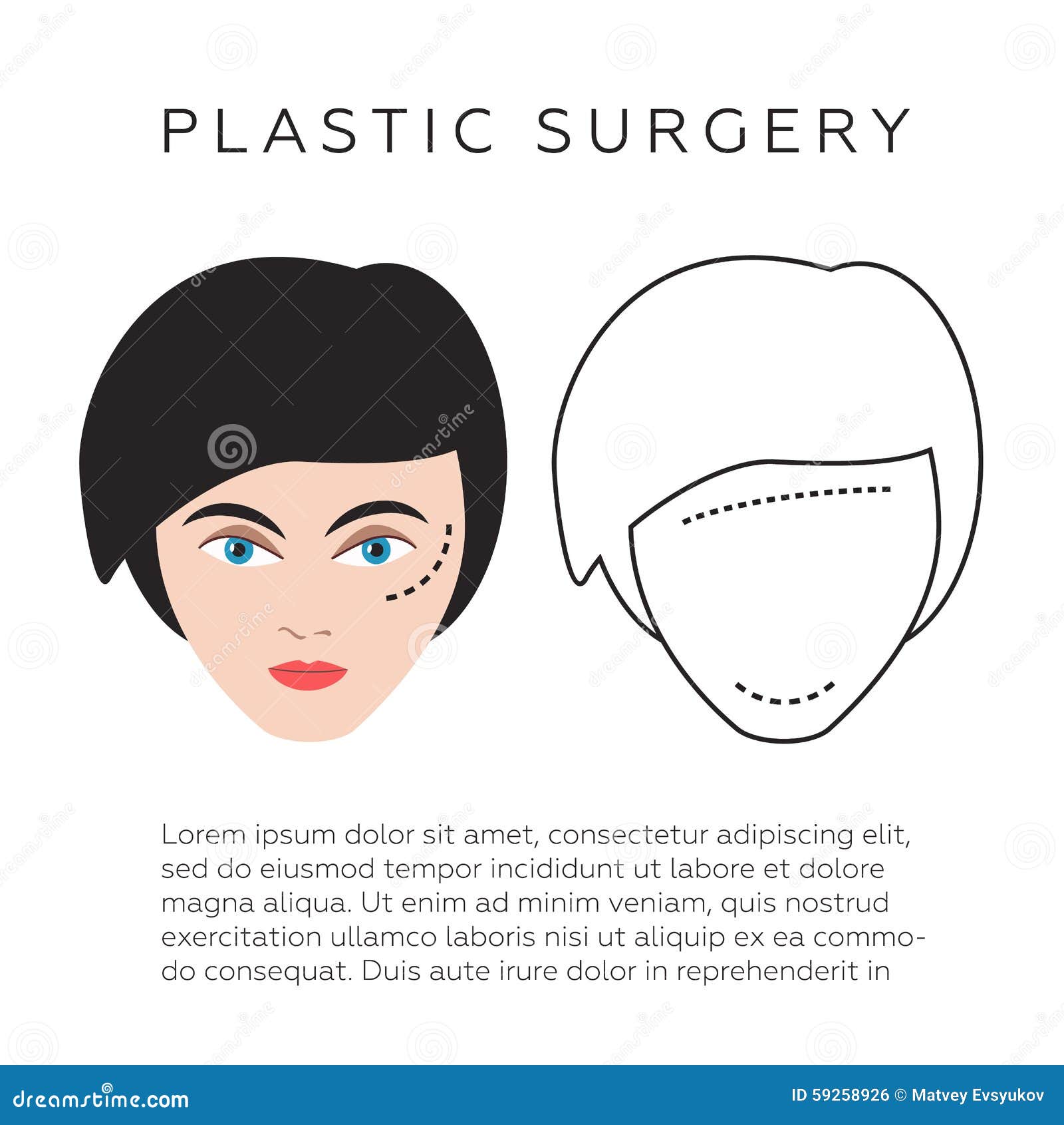 Plastic Surgery Infographics, Illustration Stock Illustration ...