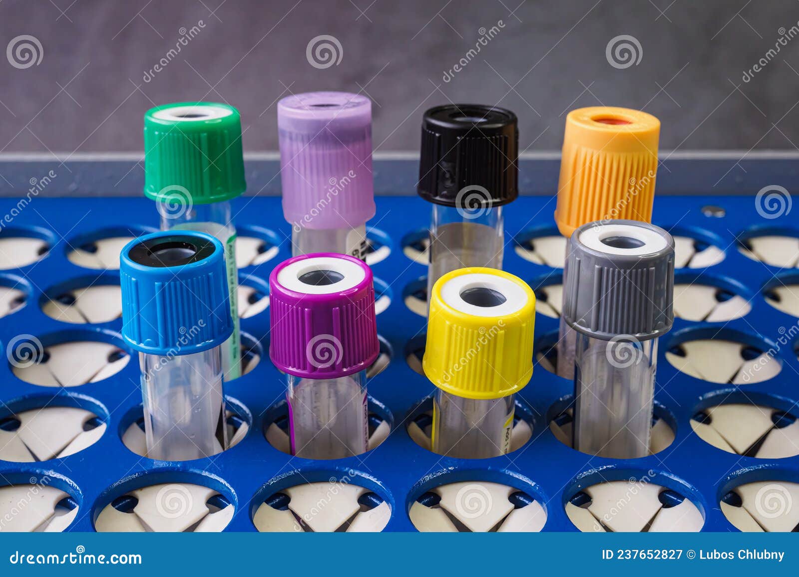 Plastic Test Tubes with Caps for the Collection of Samples. Blood ...