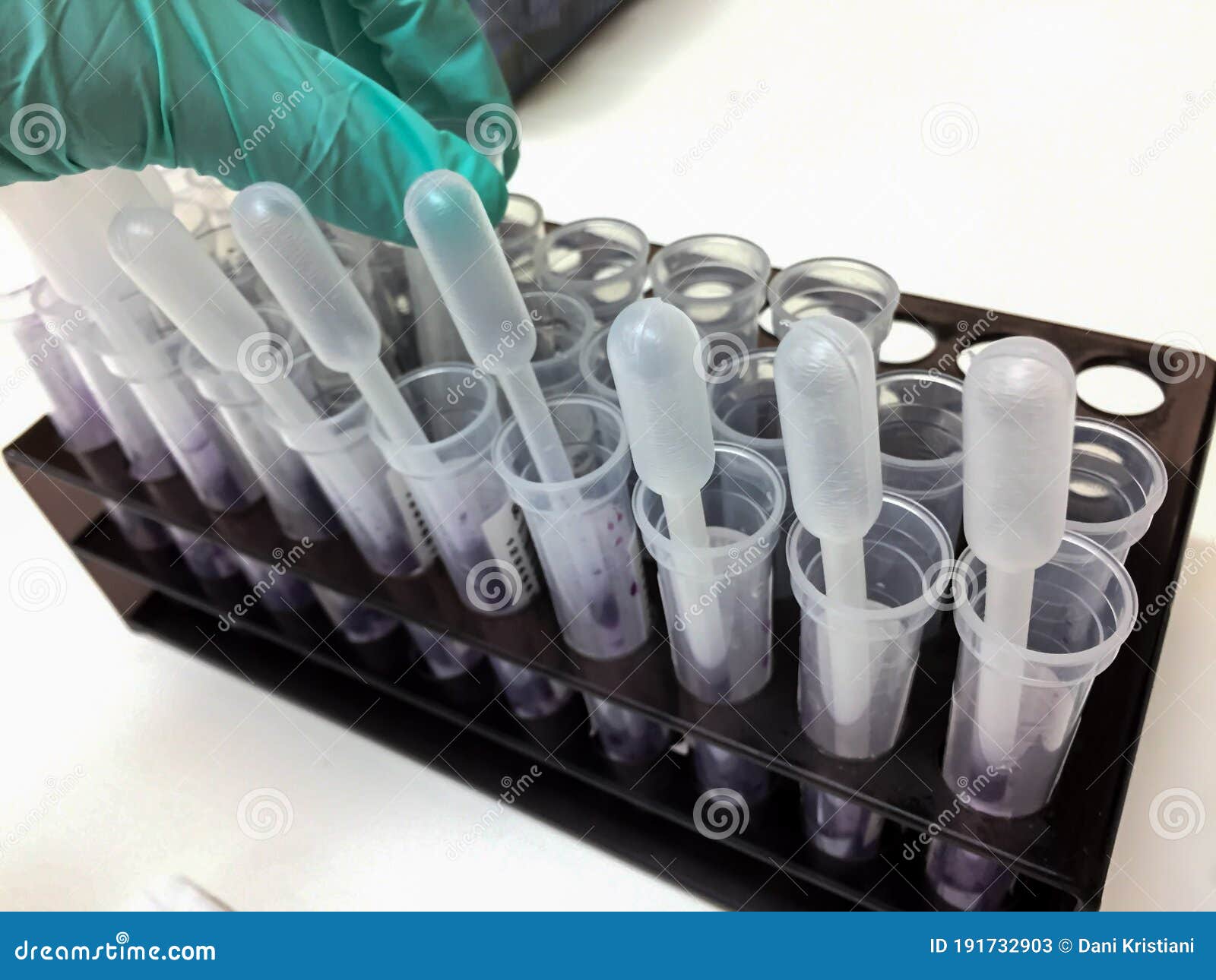 Plastic Tube for Sample Analysis on the Rack Stock Image - Image of ...