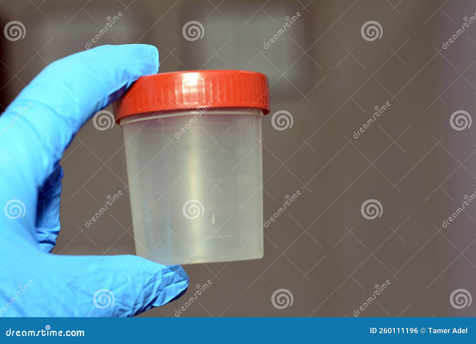 Urinalysis, Kidney Model And Urine Cup With Reagent Strip PH Paper Test ...