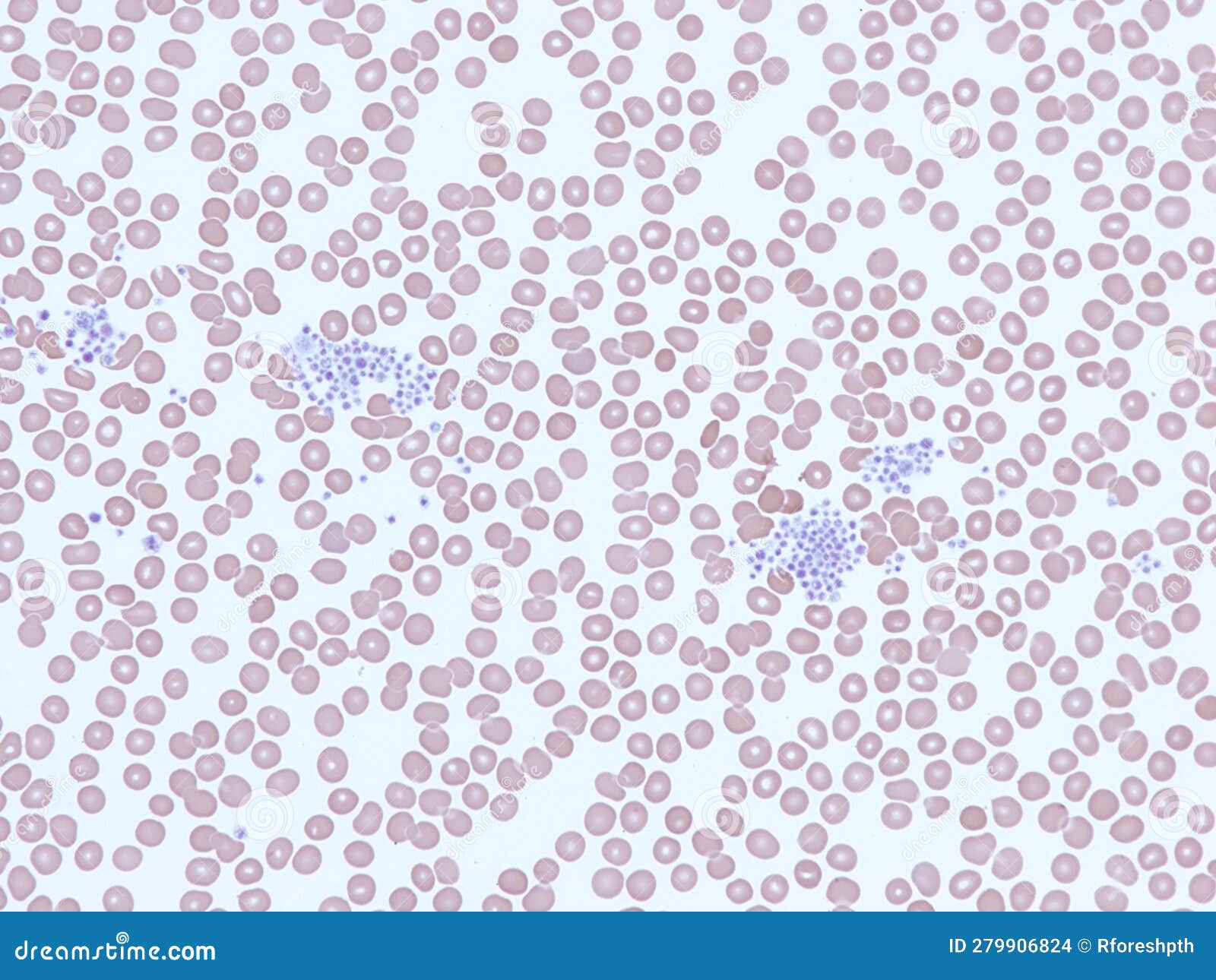 Platelet clumping. stock photo. Image of clumping, blood - 279906824