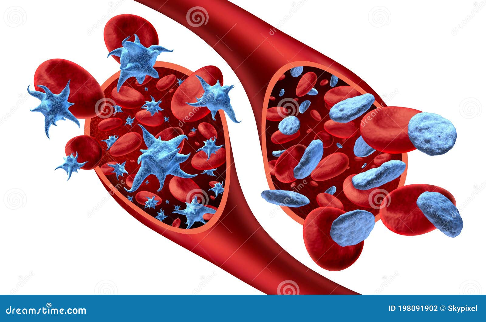 platelet and non activated platelets Coloso platelet and non activated platelets Coloso