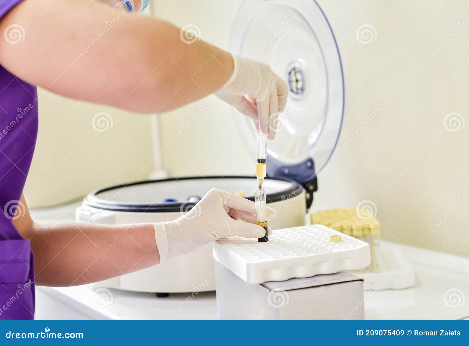 Platelet-Rich Plasma Preparation. Syringe with Plasma in Hands Stock ...