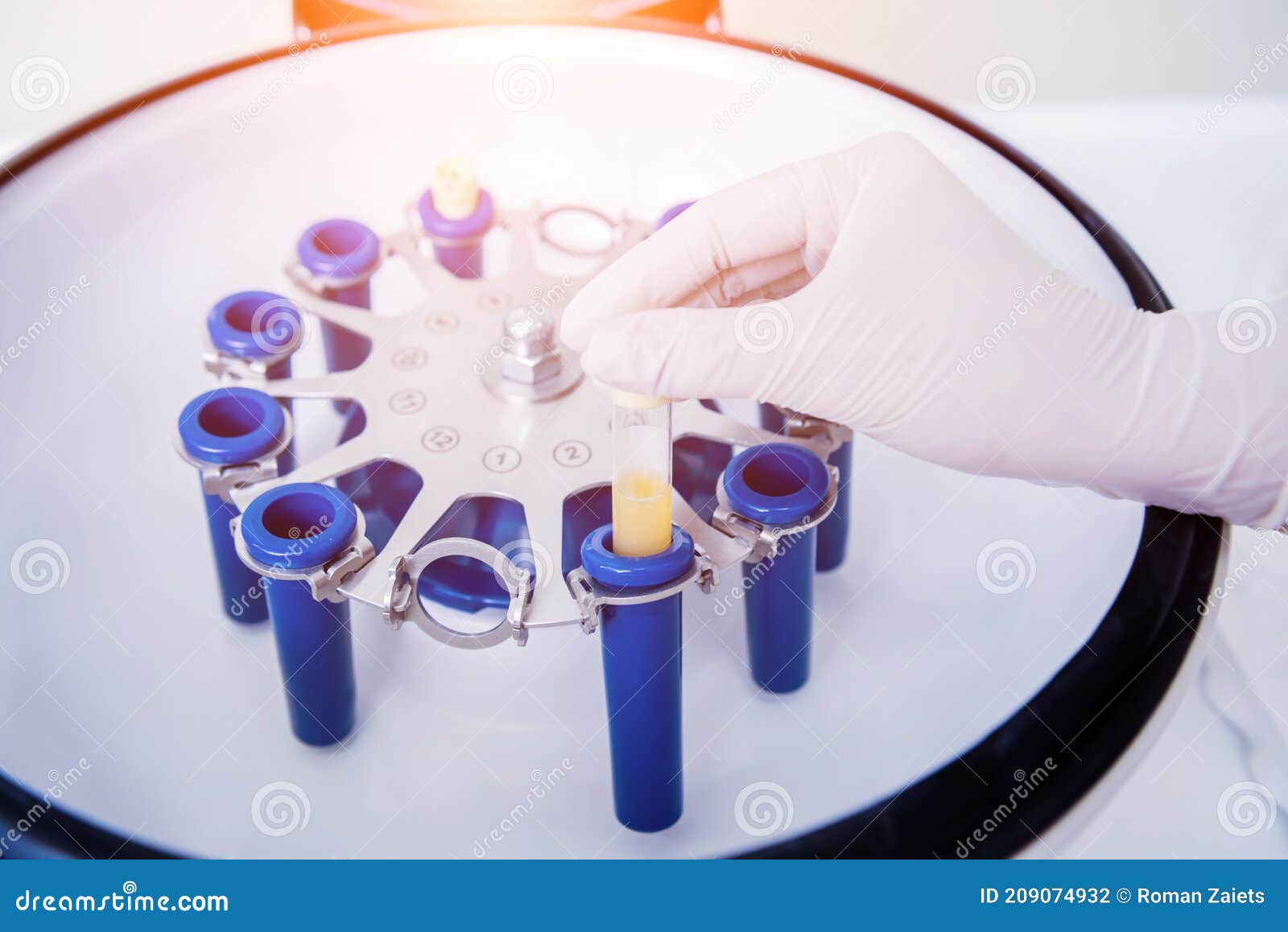 Platelet-Rich Plasma Preparation. Tube with Plasma in Hands Stock Photo ...