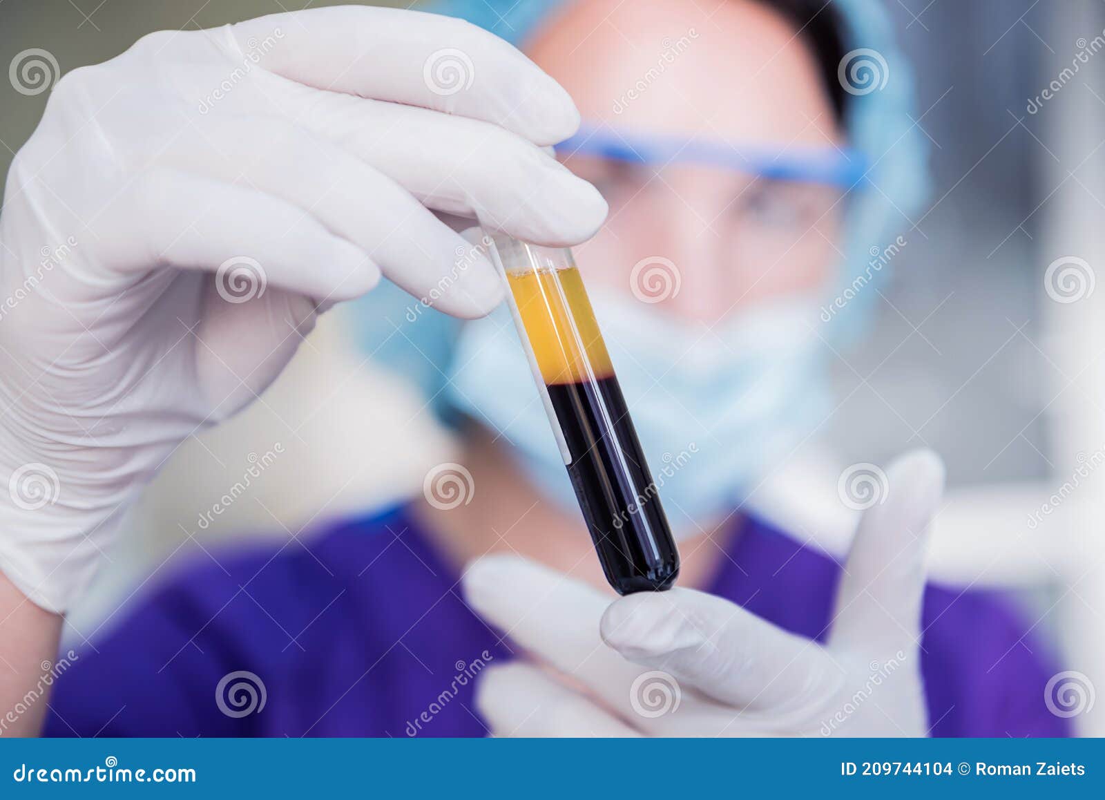 Platelet-Rich Plasma Preparation. Tube with Plasma in Hands Stock Photo ...
