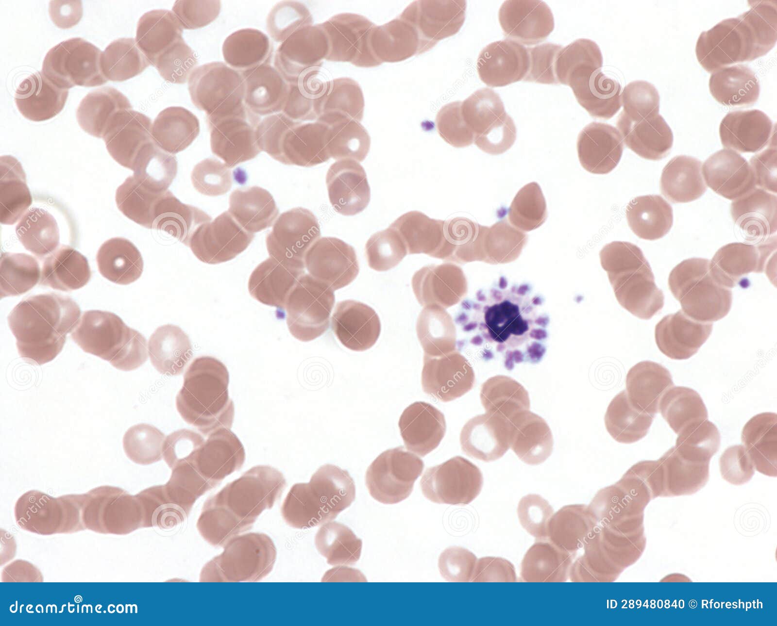 Platelet Satellitism Stock Illustrations – 1 Platelet Satellitism Stock ...