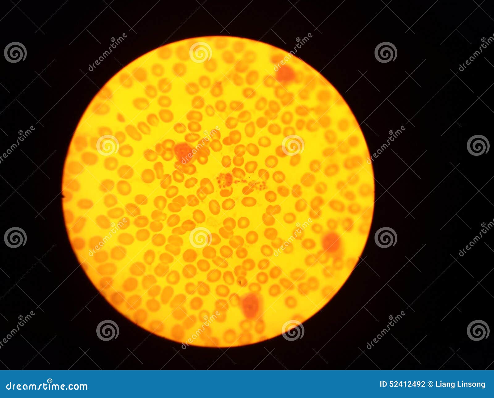 PLT stock photo. Image of medical, illness, clinical - 52412492