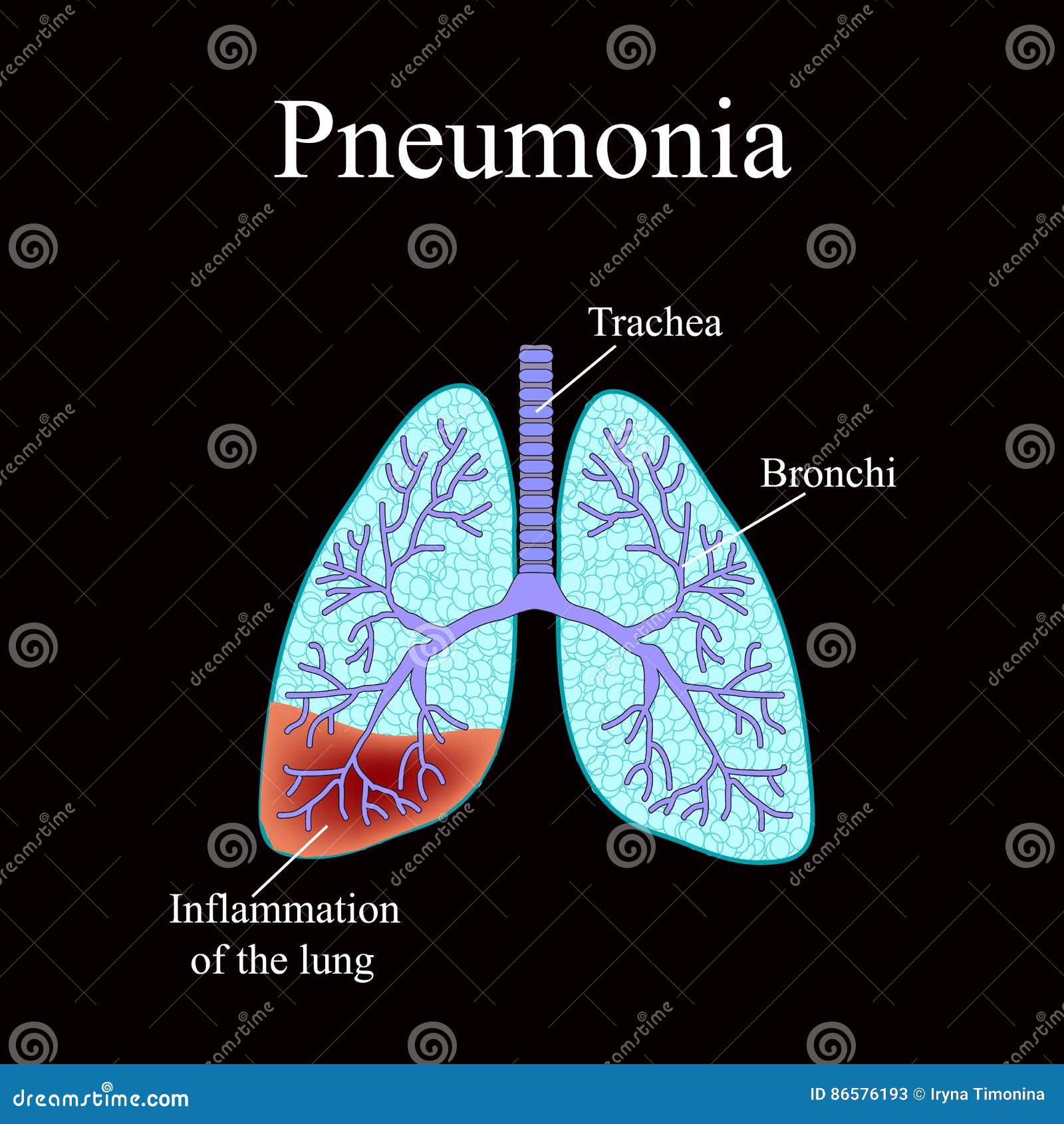 Pneumonia Virus Structure