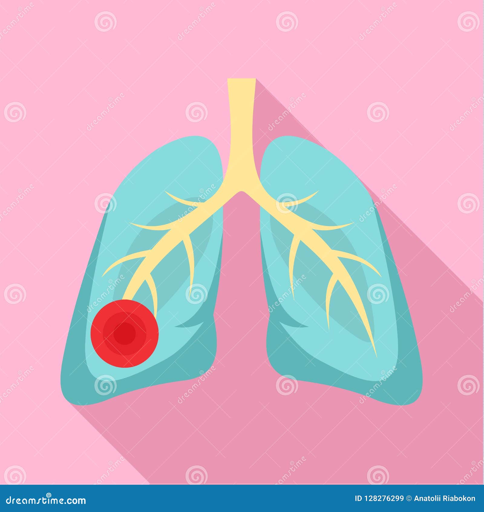 Pneumonia Lungs Icon, Flat Style Stock Vector - Illustration of biology ... Pneumonia Lungs Icon, Flat Style Stock Vector - Illustration of biology ...