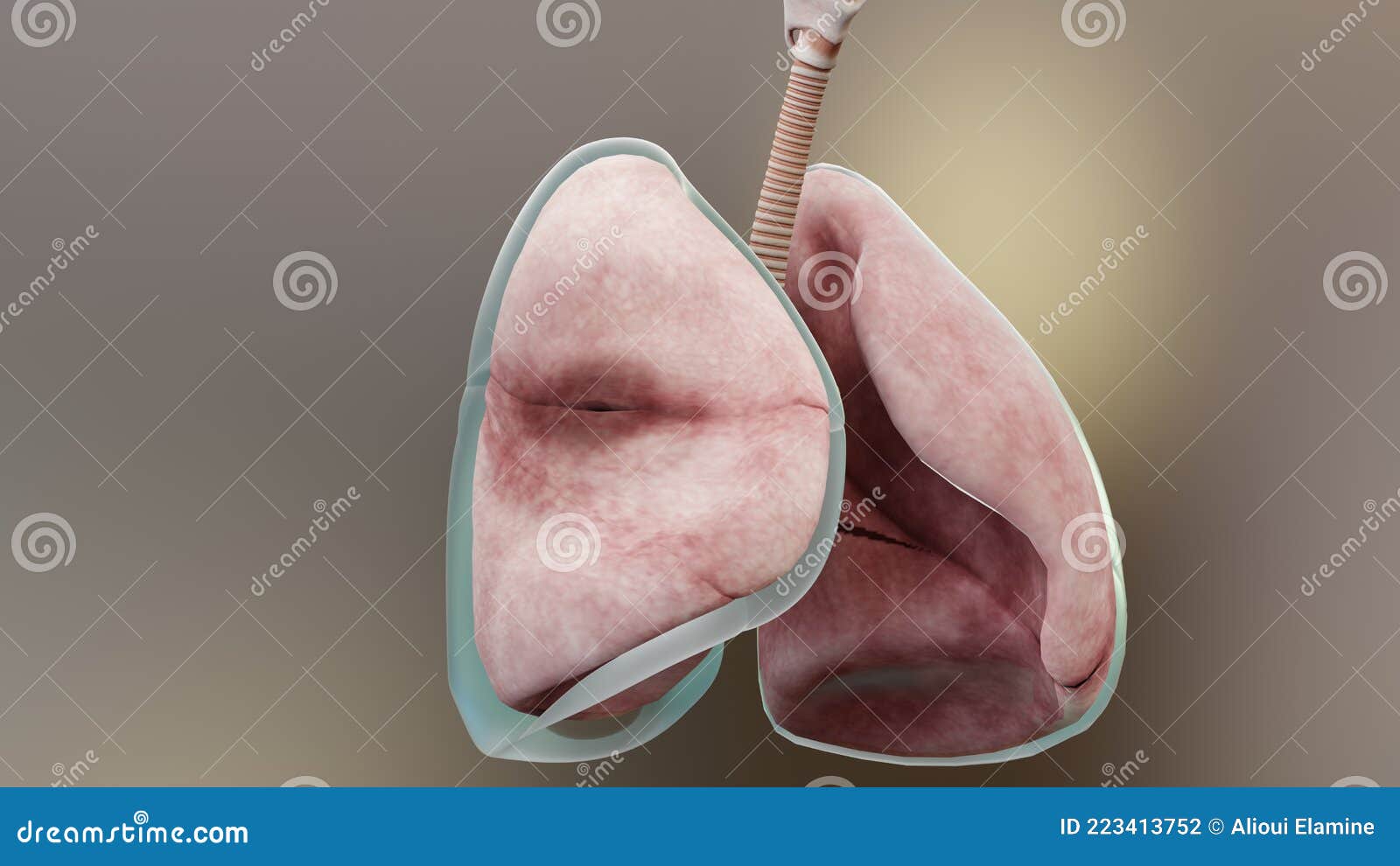 Pneumothorax stock abbildung. Illustration von krankheit - 223413752 Pneumothorax stock abbildung. Illustration von krankheit - 223413752