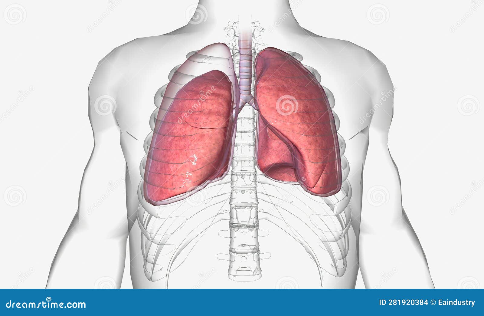 Pneumothorax is a Pulmonary Condition in Which Air Accumulates Around ...
