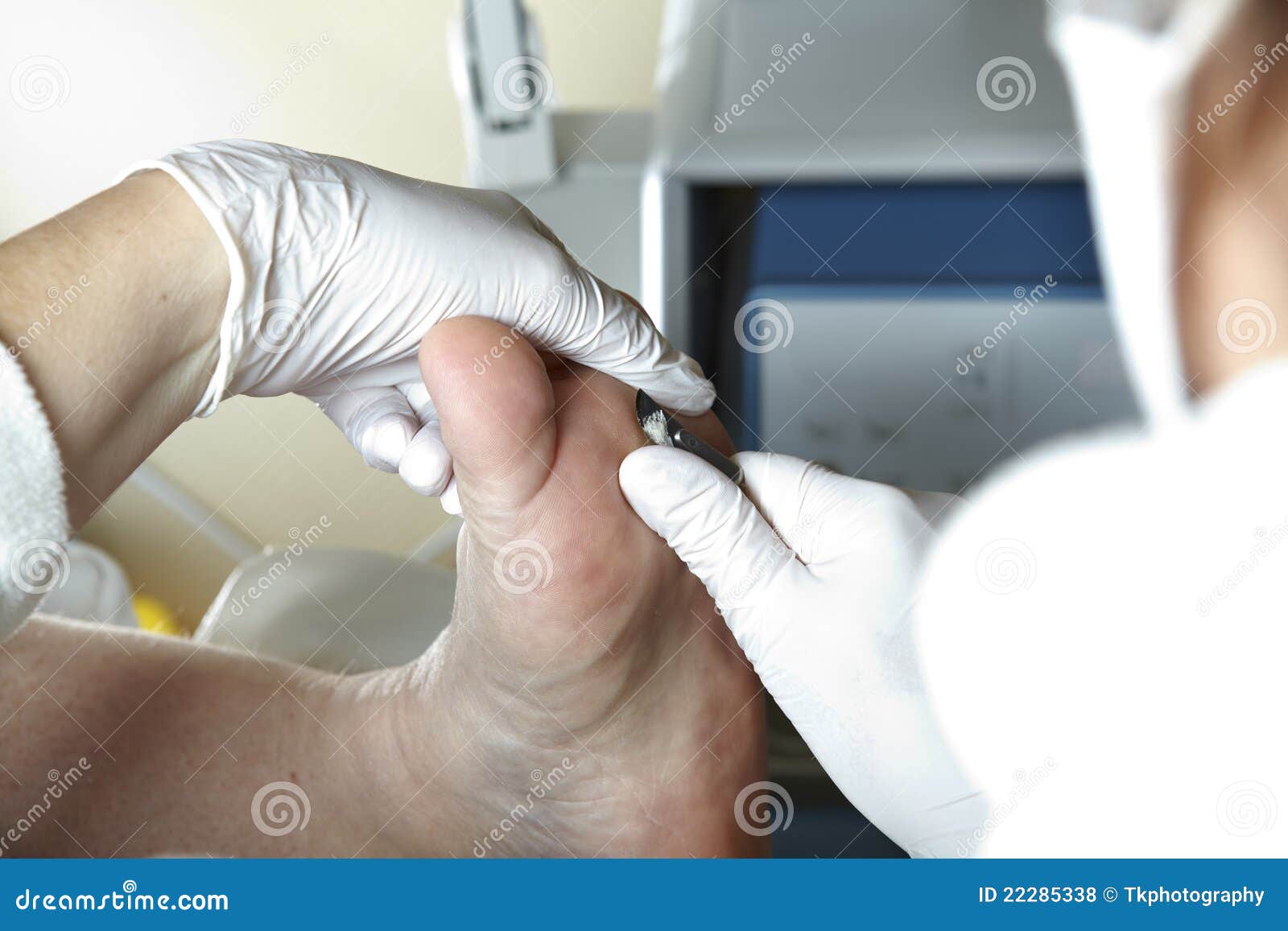 A Podiatrist Works with a Scalpel Stock Photo - Image of barefoot ...