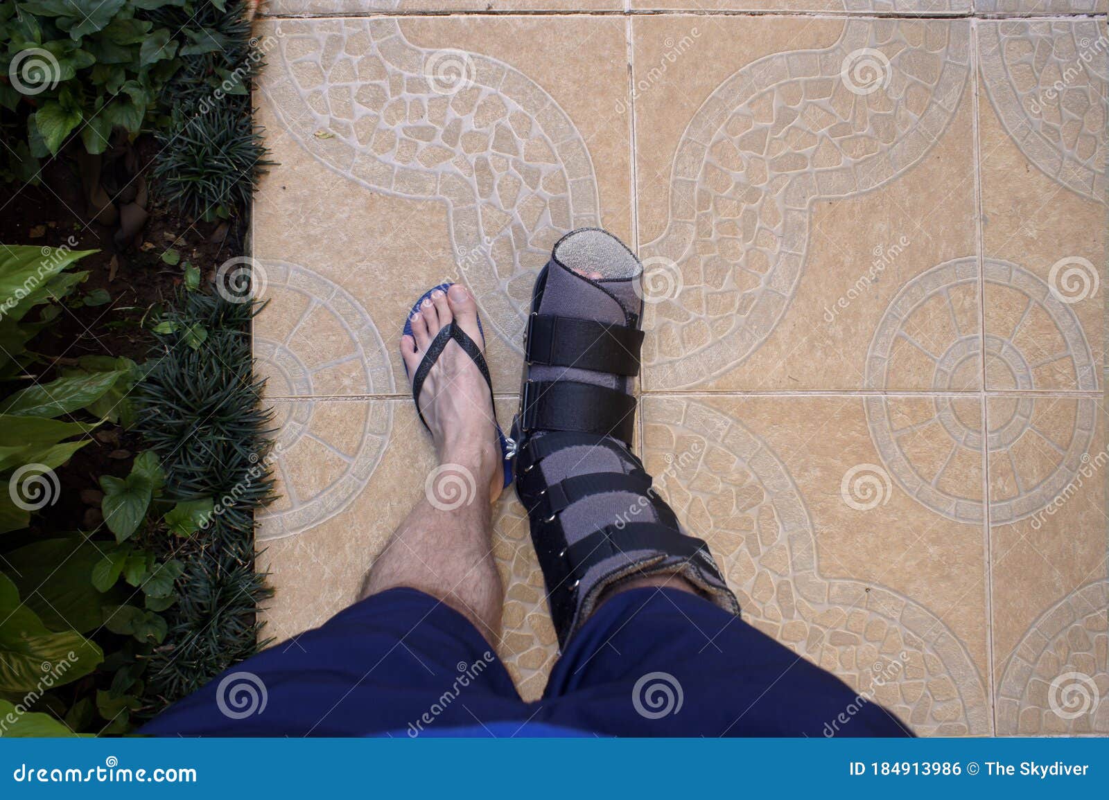 Point of View of a Broken Foot, Wearing an Orthopedic Boot. Stock Photo ...