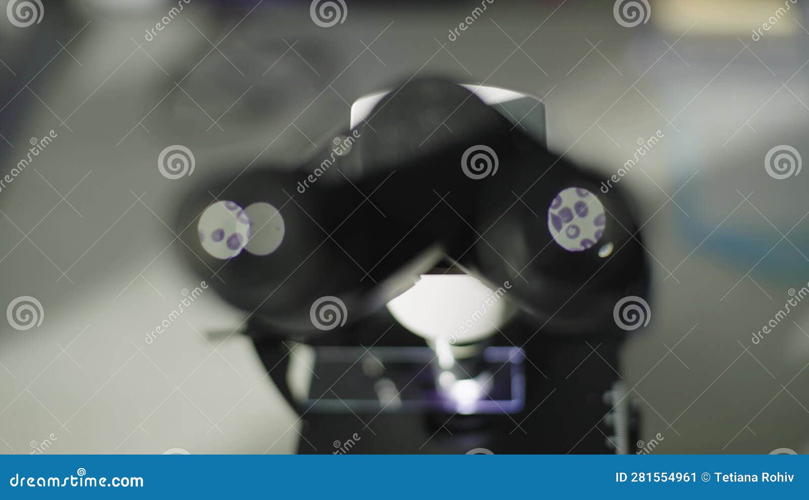 Point of View in a Microscope in Which Cells are Visible. Stock Video ...