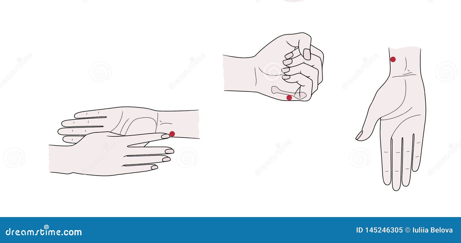 Points Actifs D'acuponcture Sur Les Mains D'isolement Sur Le Fond Blanc ...