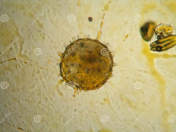 Pollen under a microscope stock image. Image of magnification - 12544435