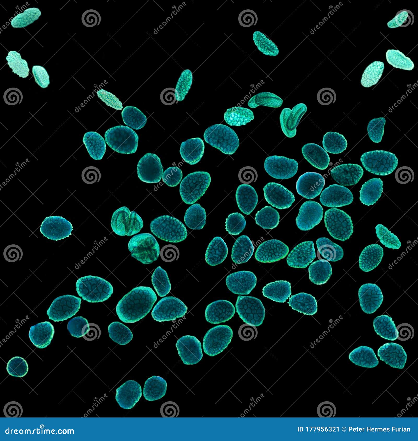 Light Microscope Hepatic Hemosiderosis Of Liver Pathology Royalty Free Stock Image