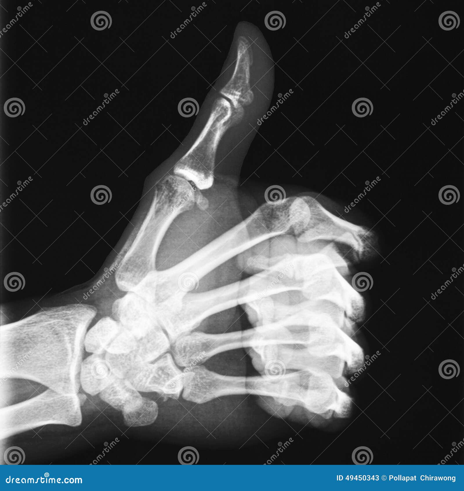 Pollice in su immagine stock. Immagine di amore, anatomia - 49450343