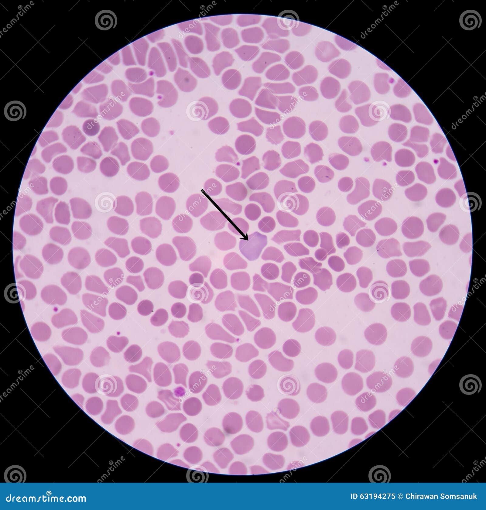 Polychromasia imagen de archivo. Imagen de microscopio - 63194275