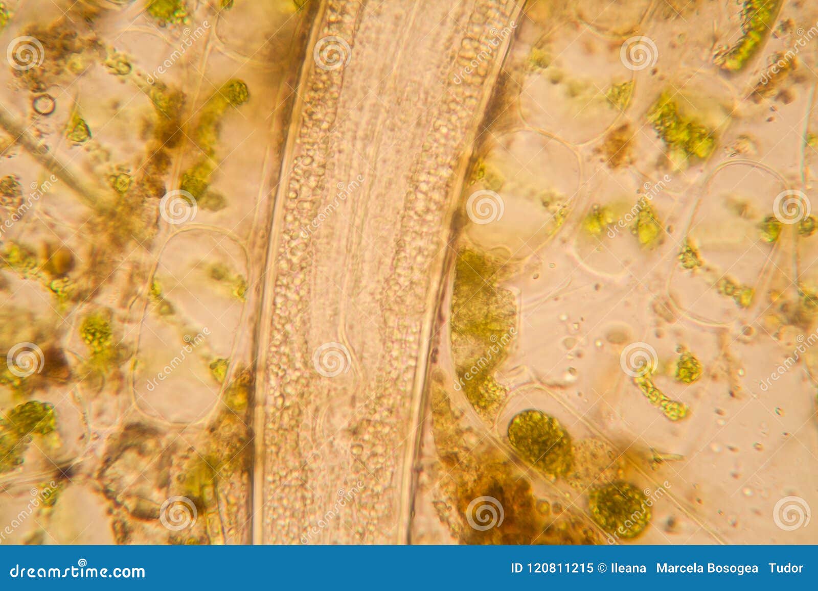 Pond Water Plankton and Algae at the Microscope. Nematode Stock Image ...