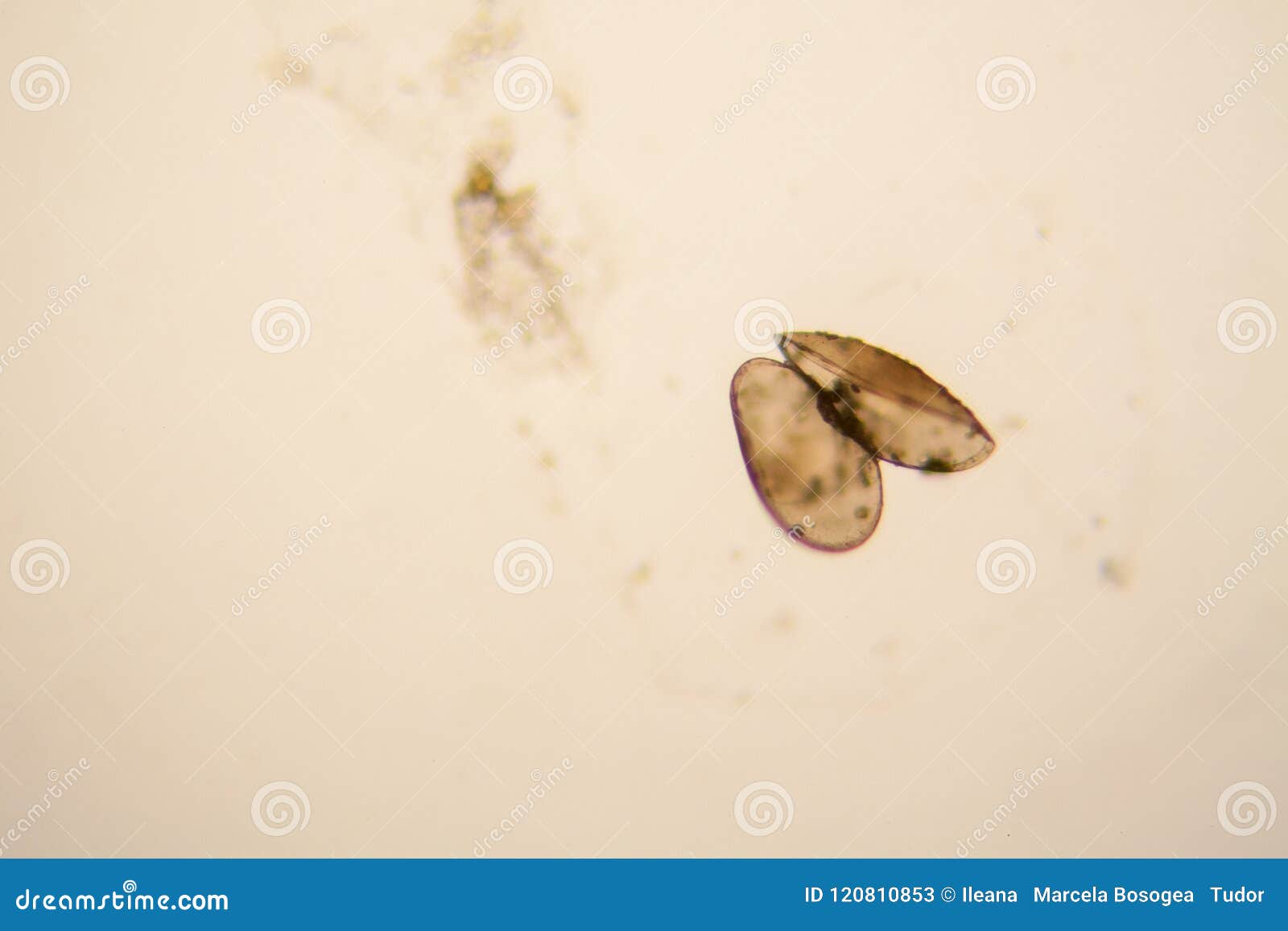 Pond Water Plankton and Algae at the Microscope. Ostracod Crustacean ...