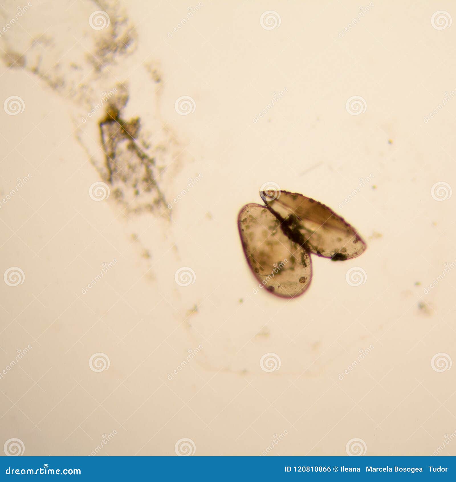 Pond Water Plankton and Algae at the Microscope. Ostracod Crustacean ...