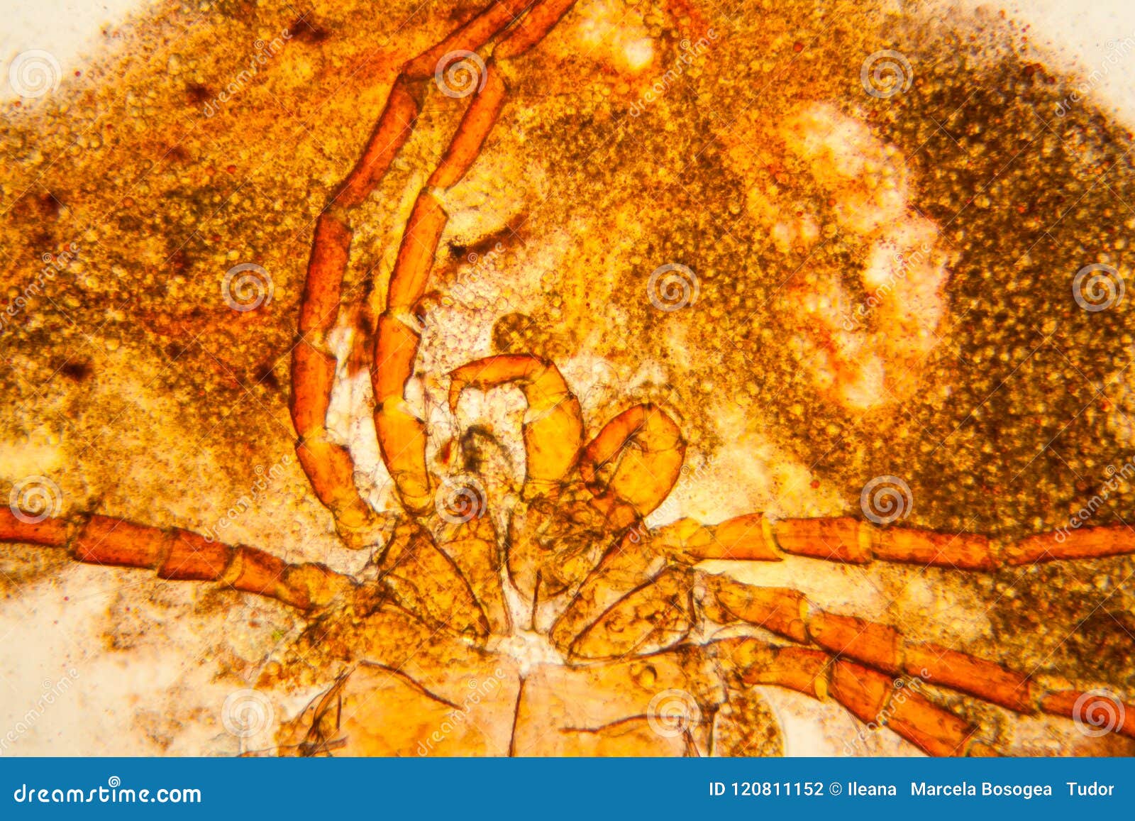 Pond Water Plankton and Algae at the Microscope. Pond Mite Stock Photo ...